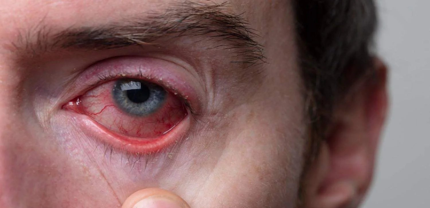 Dristy Eye Hospital, Chouparan